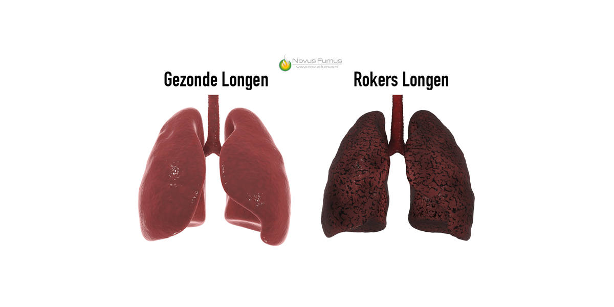 Teer en nicotine in sigaretten: schadelijke effecten op de gezondheid ...