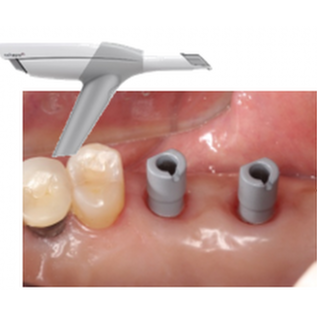 Scan Body Osstem - ImplAg-Shop