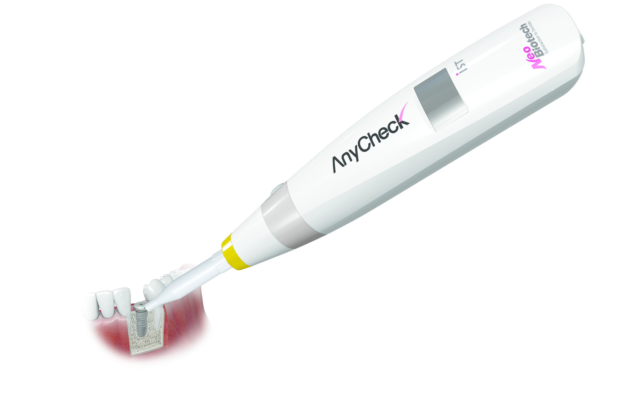 AnyCheck - ImplAg-Shop