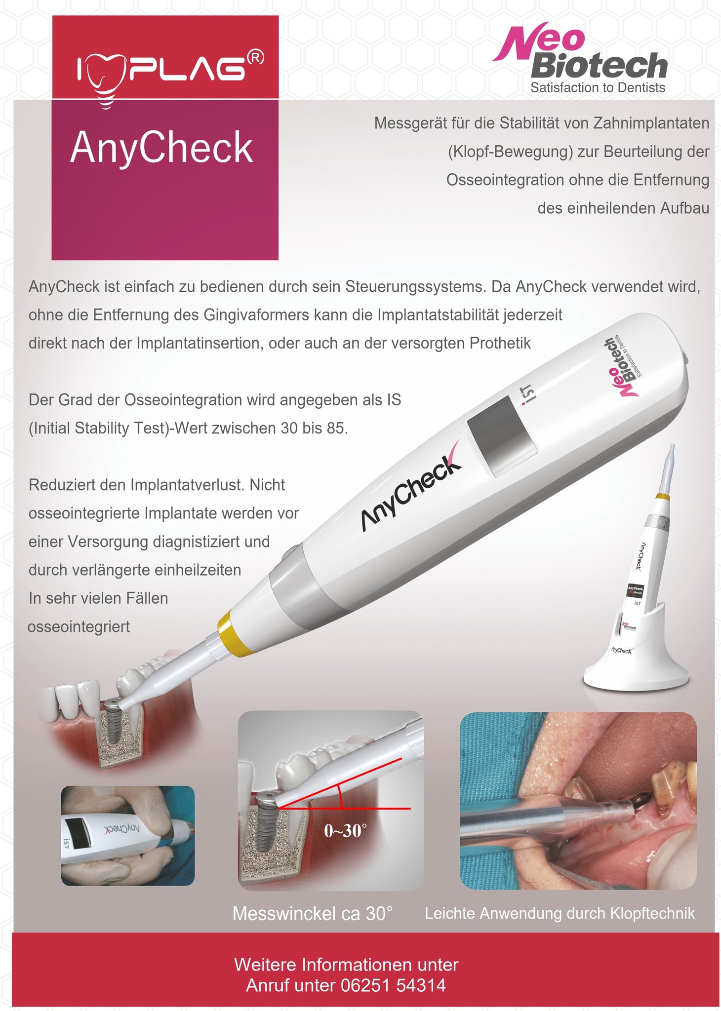 AnyCheck - ImplAg-Shop