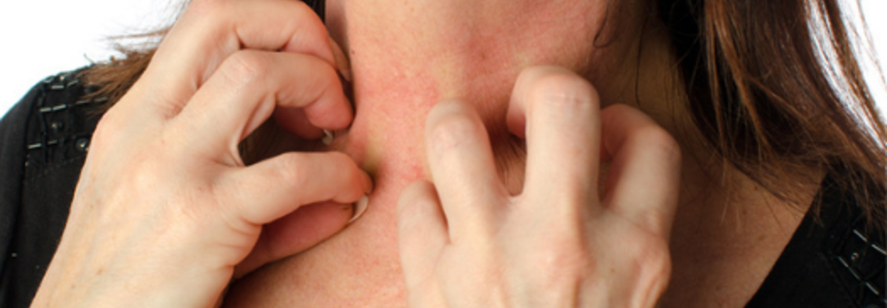 Wat is netelroos en waardoor wordt het veroorzaakt? - Apotheek en huid