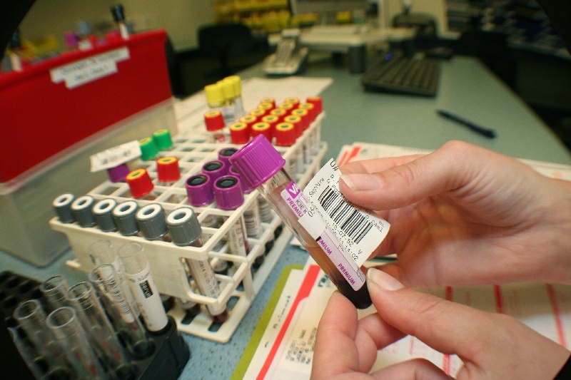 Testen op prostaatkanker? Test je PSA - Bloedwaardentest B.V