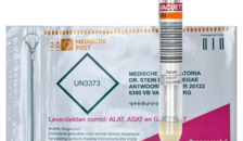 Leverziekten: ALAT, ASAT en Gamma GT - Bloedwaardentest B.V