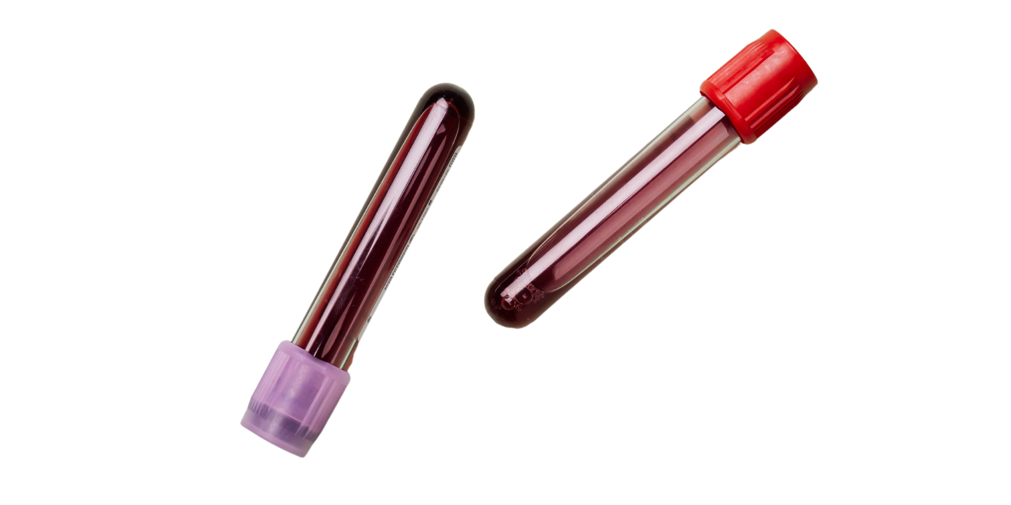 Hematocriet te hoog: Oorzaken, gevolgen en oplossingen ...