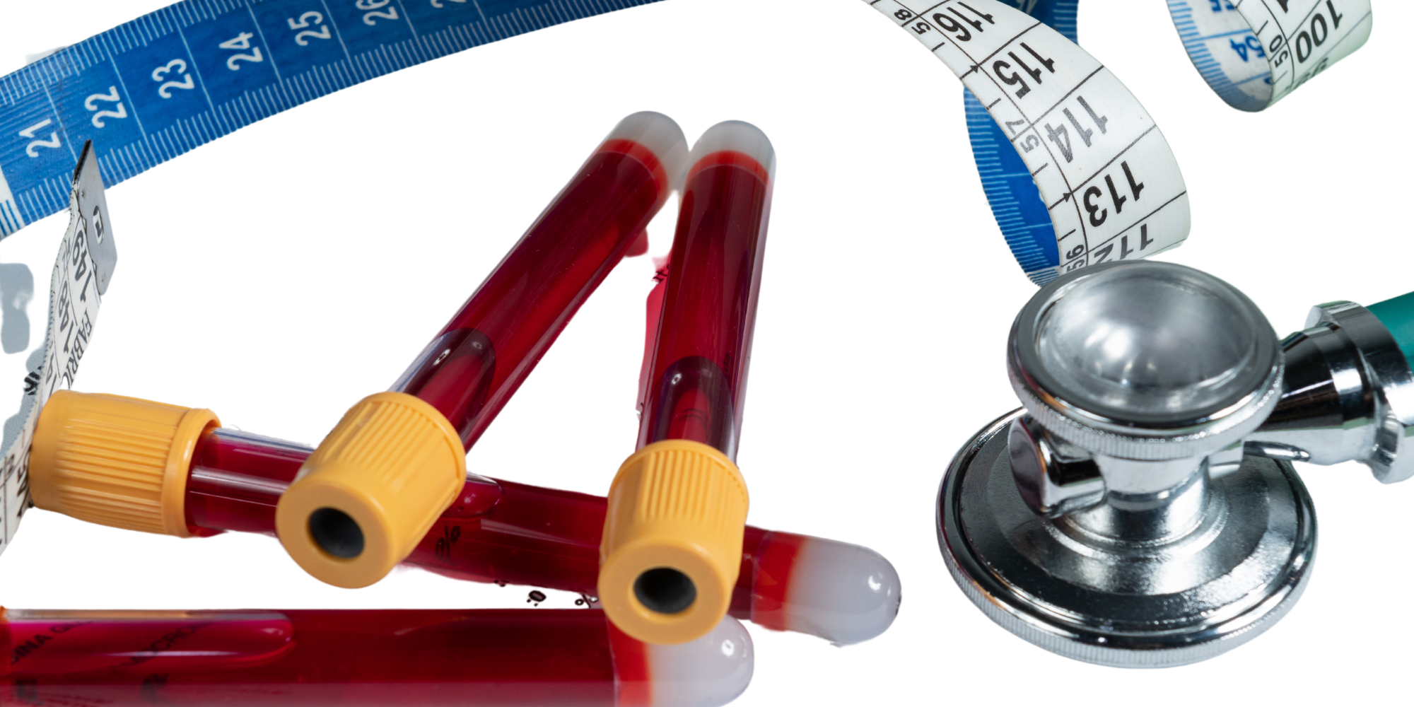 Ziekte van Wilson: een zeldzame maar behandelbare koperstapelingsziekte ...