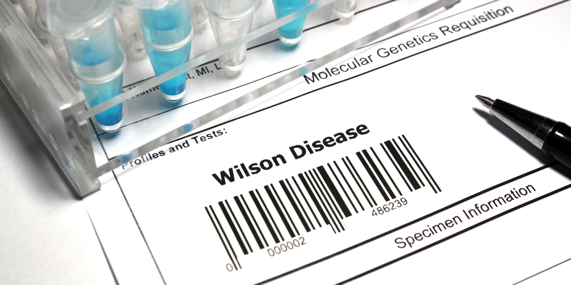 De ziekte van Wilson: Oorzaken, Symptomen, Diagnose en Behandeling ...