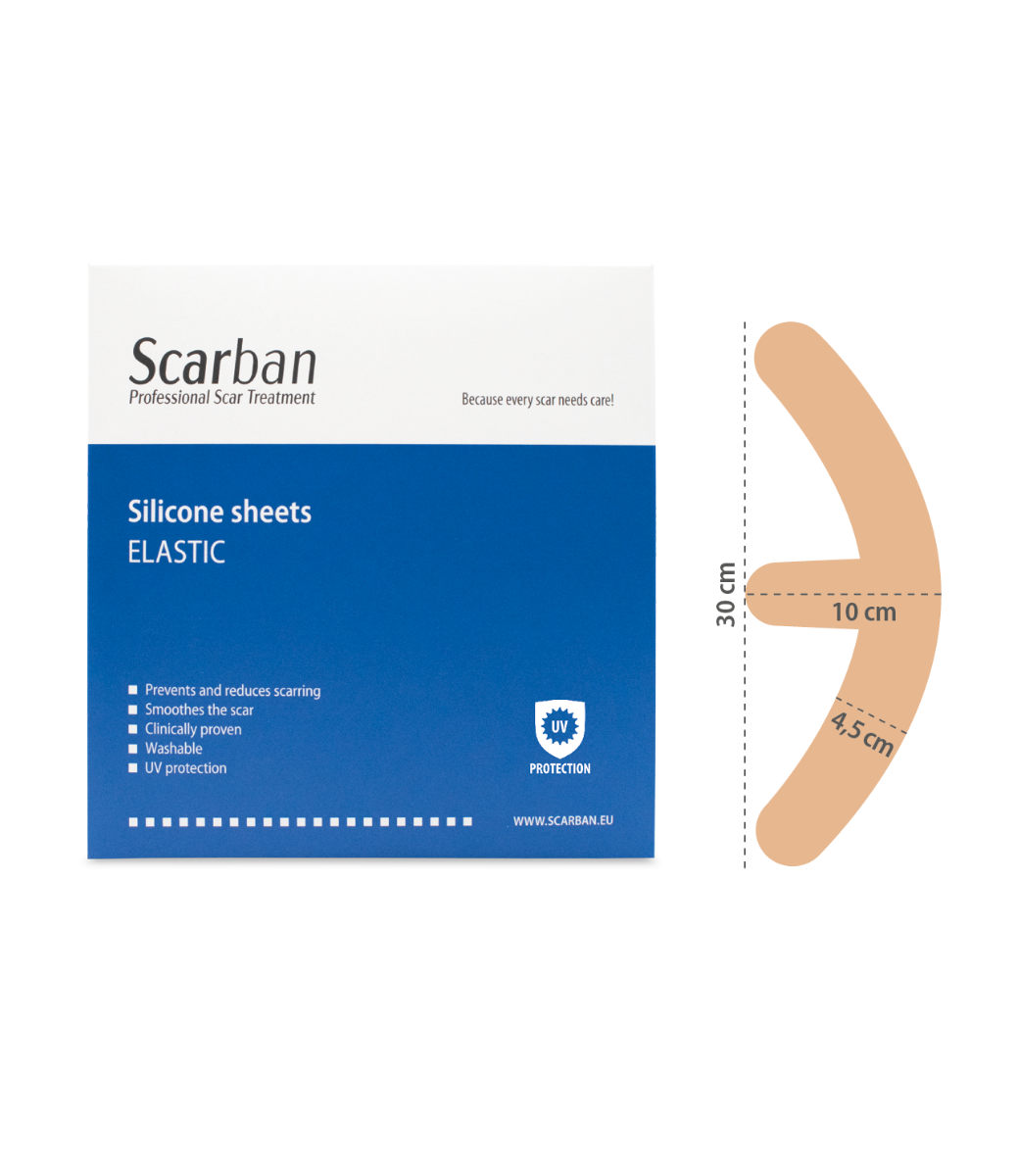 Scarban Elastic litteken siliconenpleister Mamma Anker - Dermatologie ...