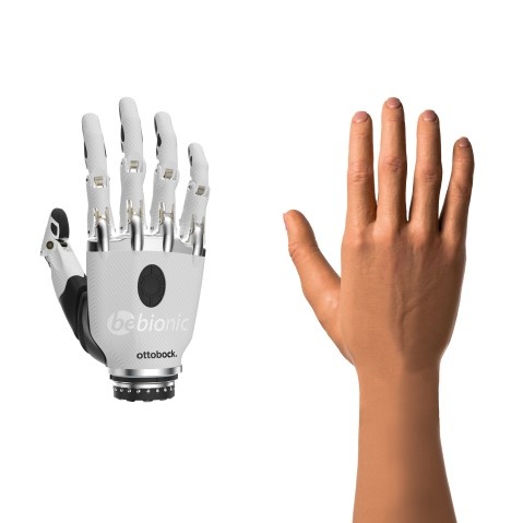 Bebionic Myo Elektrische handprothese - OrthoVanReeth