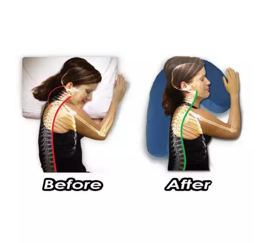 Ergonomisch zijslaapkussen - ThuiszorgWebshop.nl