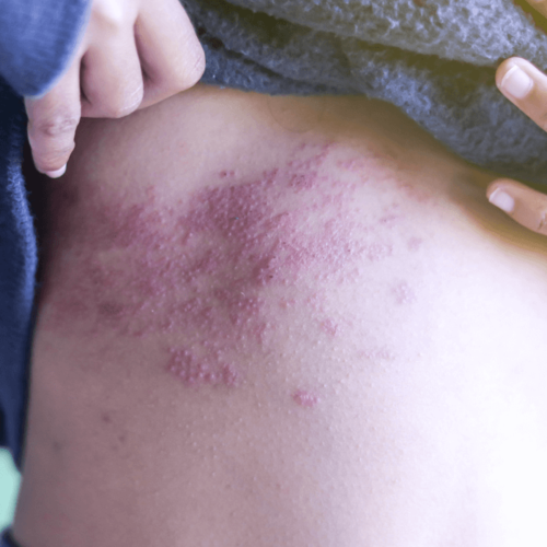 Sanvita Healthy: helpt jou naar een gezonde huid! - Sanvita Healthy