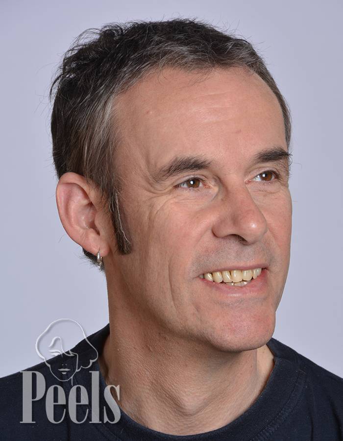 Handgeknoopte bakkebaard van echt haar, type 9221 - Peels Haarmode