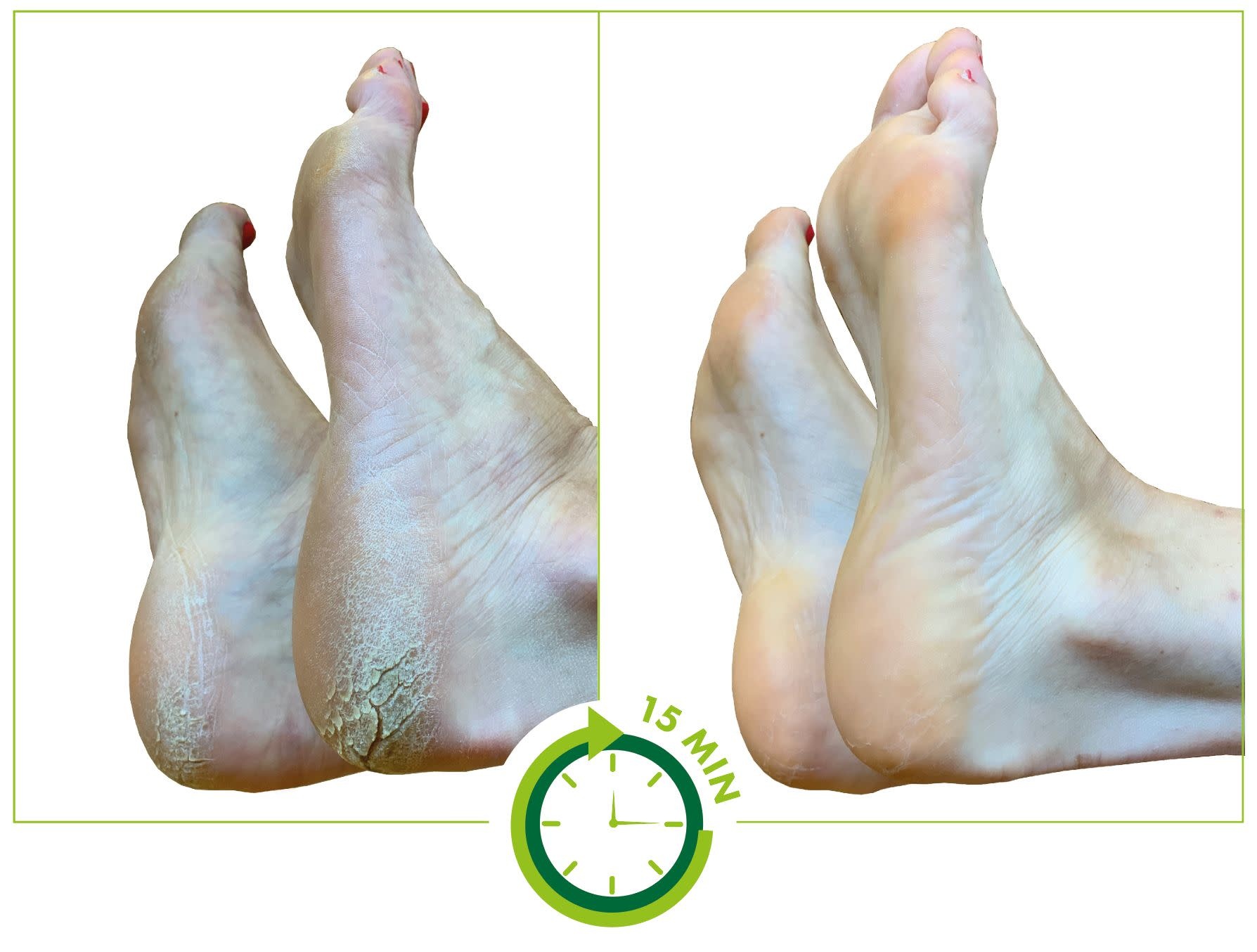 Mavex Calluspeeling Vegetal 10pk - NSI Hair Nail and Beauty