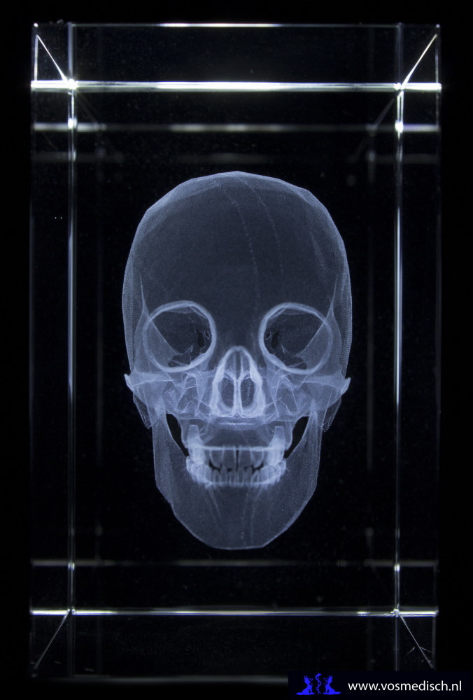 3D model van de menselijke schedel in glazen blok - Vosmedisch.nl - A ...