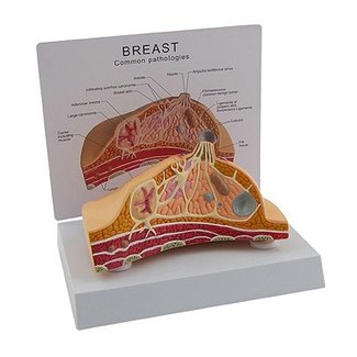 Borstmodellen - Vosmedisch.nl - A. Vos en Zoons B.V.