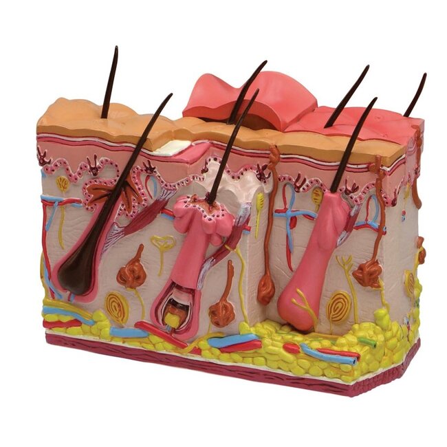 Anatomisch model van de Huid met eerste, tweede en derdegraads ...