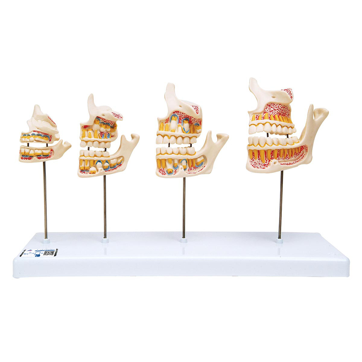 Anatomisch model van het ontwikkeling van het gebit - 3B Scientific ...