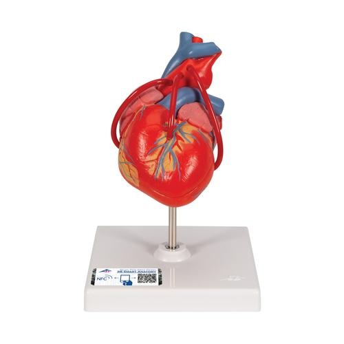 Hart model 2-delig Bypass - Anatomie menselijk hart - 3B Scientific ...