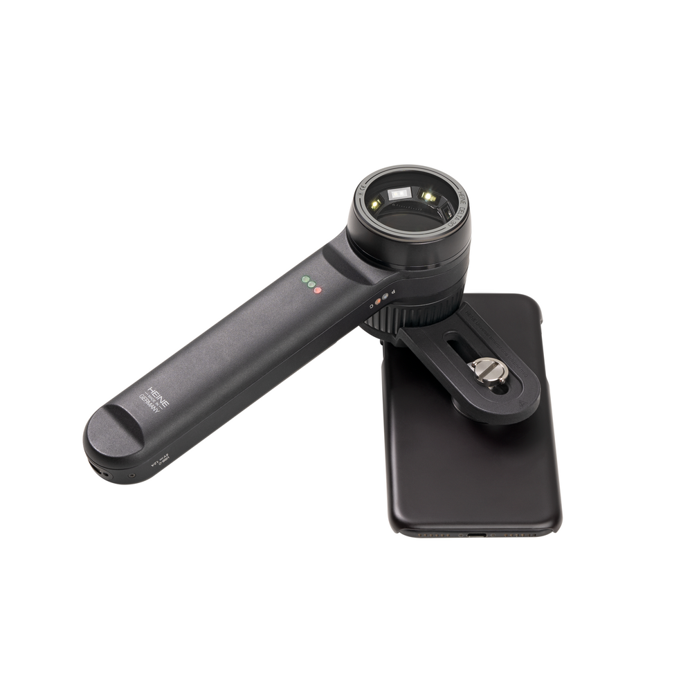 Heine DELTA 30 PRO Dermatoscope - dé professionele dermatoscoop ...
