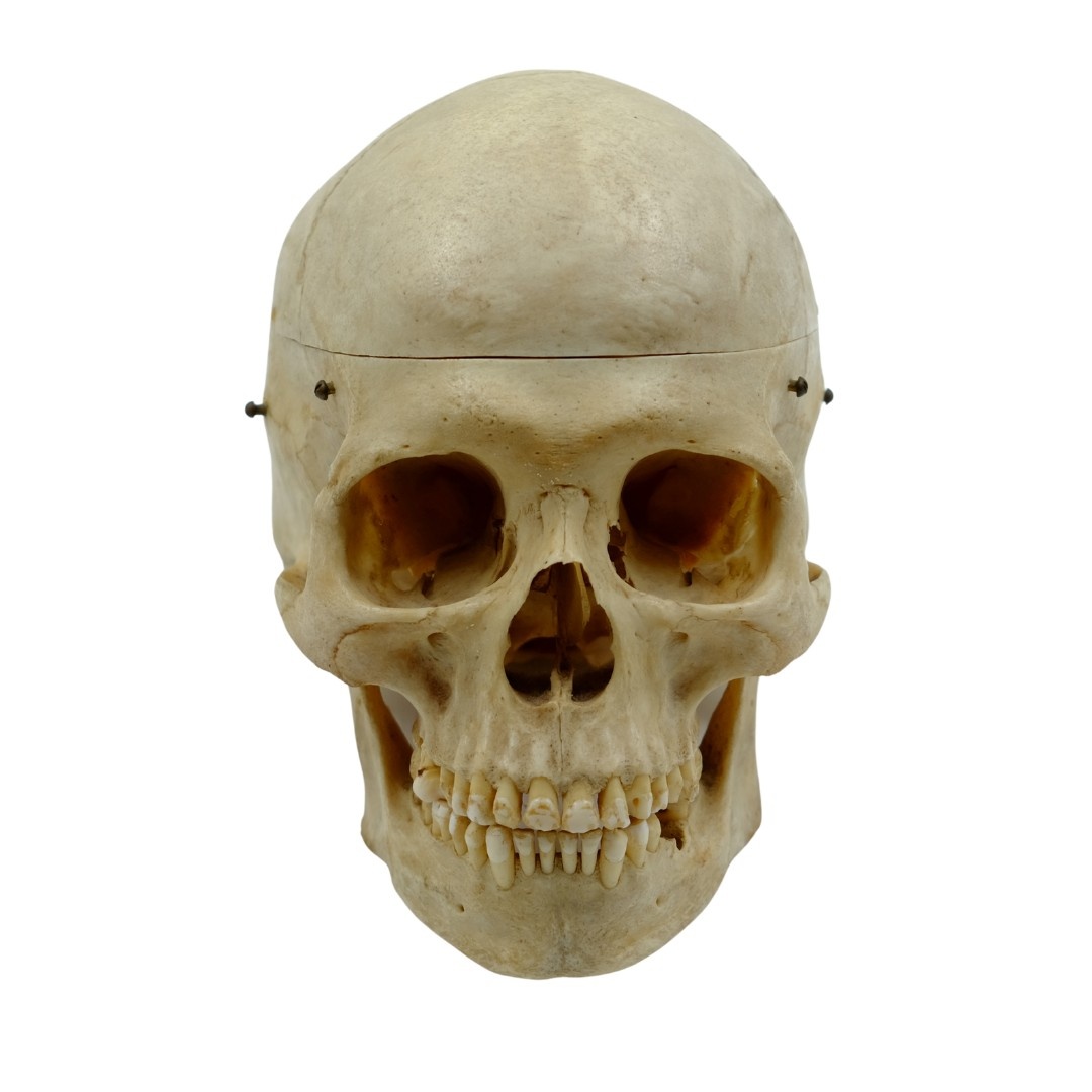 Schedel mens (A) - De Museumwinkel.com