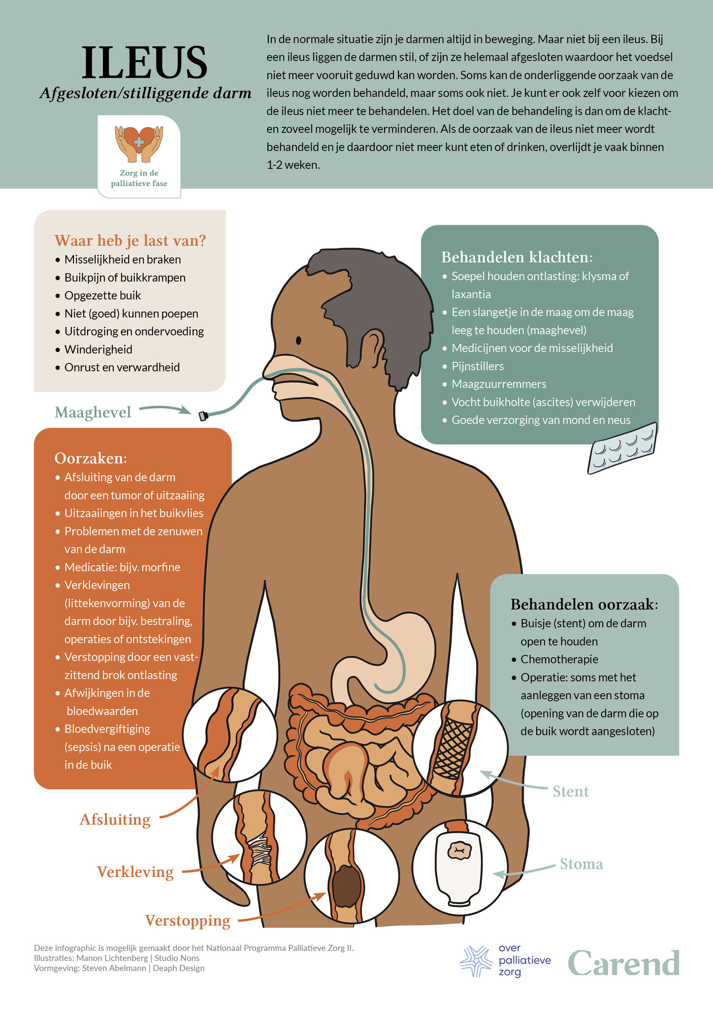 Poster Ileus - shop.pznl