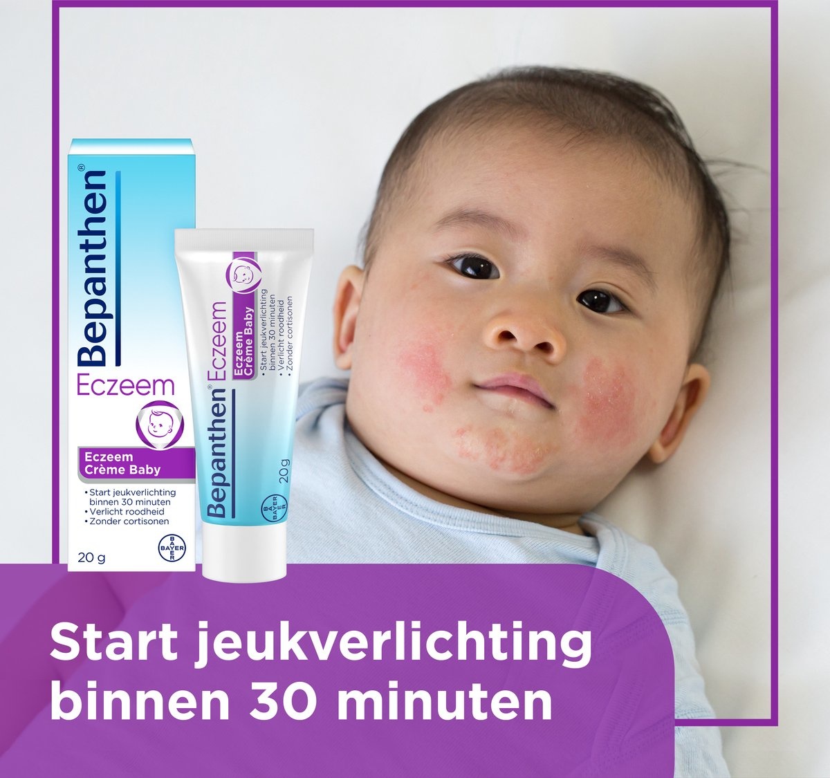 Bepanthen Eczema Cream Baby - 20g - Onlinevoordeelshop