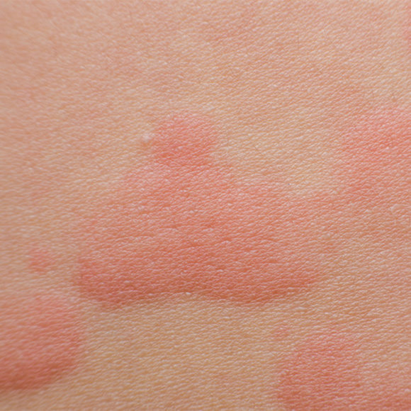 Skin Problem - Het CosmeticaHuis