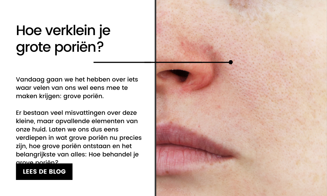 Hoe verklein je grote poriën? - Care for Skin