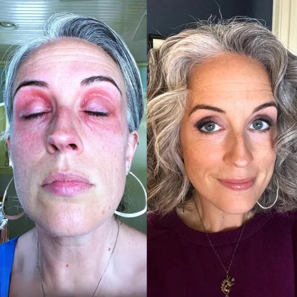 Hydrosil ooggel voor de droge huid rond de ogen - Eczeem ooggel - Nisim