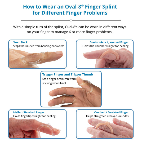 Oval-8 Clear finger splints - Stockx Medical