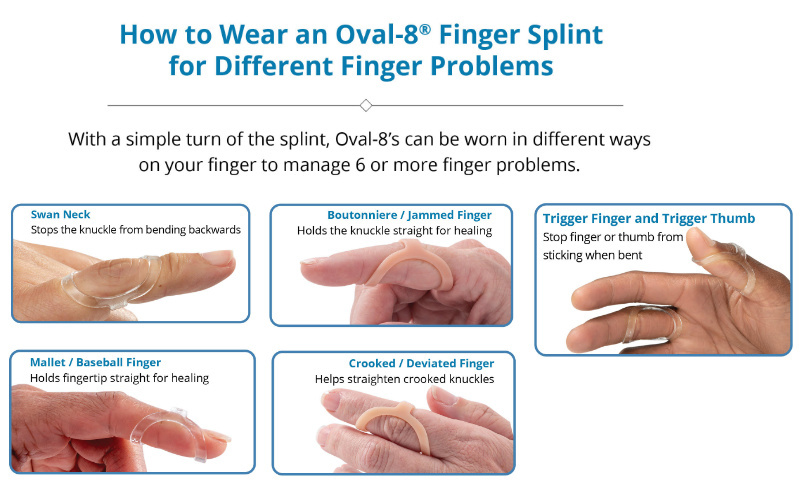 Oval-8 Clear finger splints sizing set - Stockx Medical