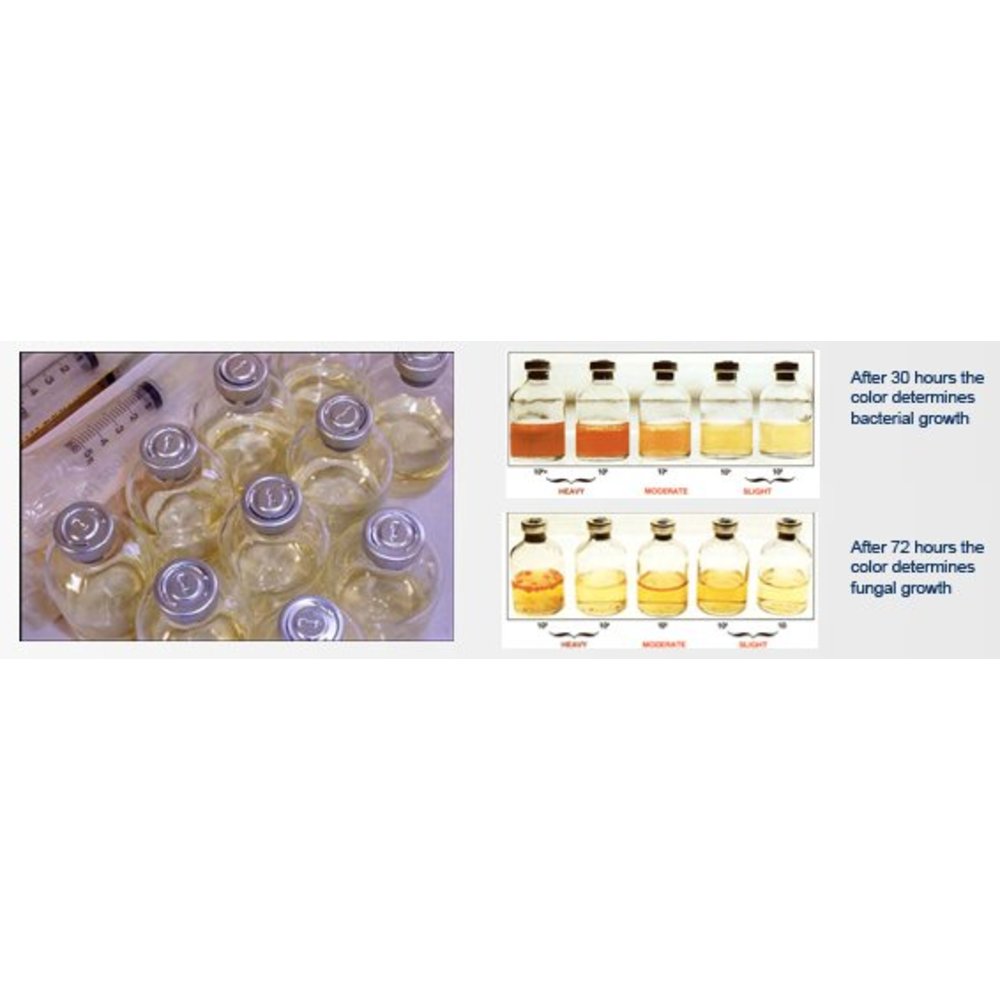 Test kit to detect microbial and fungal growth in diesel fuel - VMP